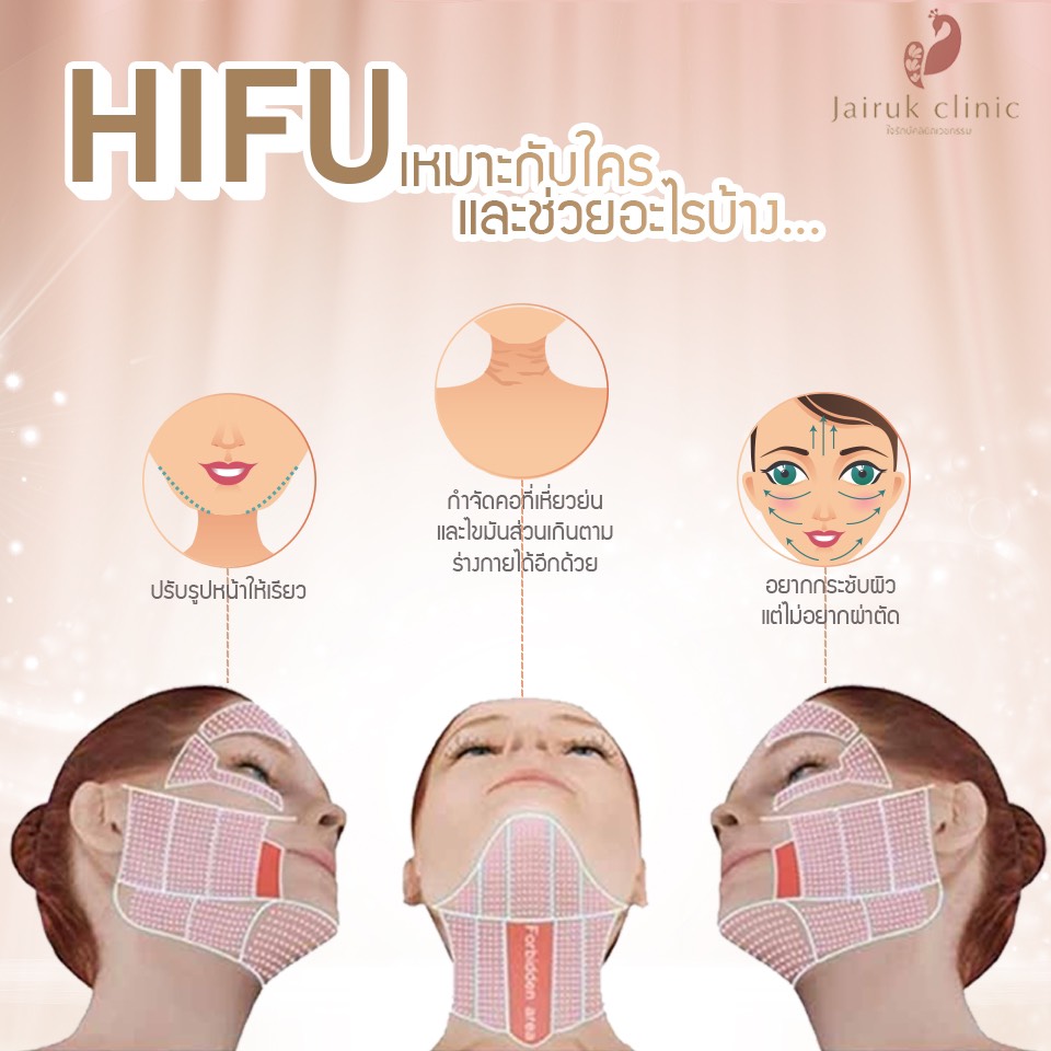 MMFU /HIFU - Jairuk clinic